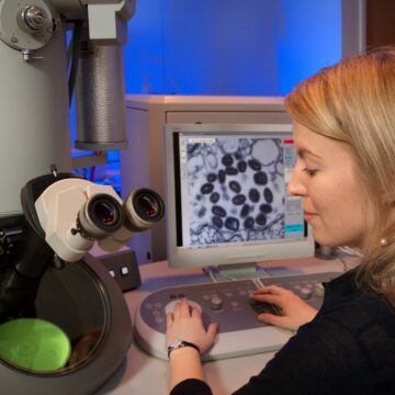 What Is The Difference Between Magnification And Resolution ...